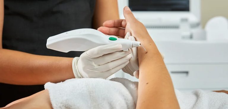 Best Plasma Pen or Plexr Device Treatment in Williamsport, PA.